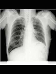 Dynamic Digital Radiography | Konica Minolta Healthcare Americas