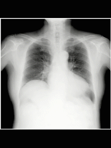 Dynamic Digital Radiography | Konica Minolta Healthcare Americas